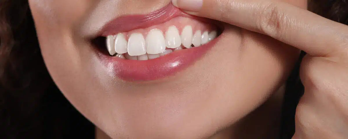 From Painful Smile to Self-Confidence – My Journey to Healthy Gums ...