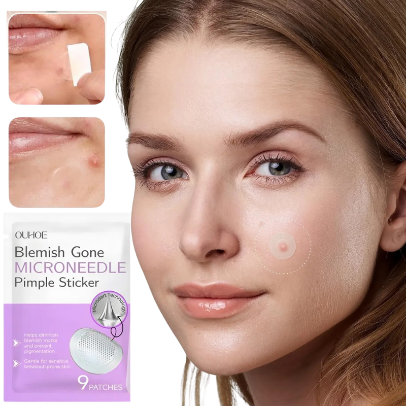 Microneedle Pimple Sticker | Gerichte verzorging voor diepe puistjes ...